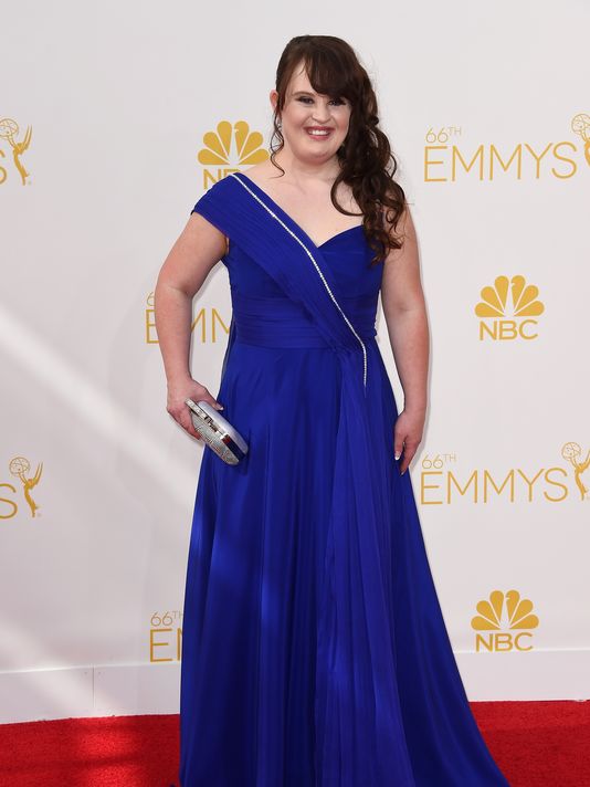 First model with Down syndrome in New York Fashion Week | cbs19.tv